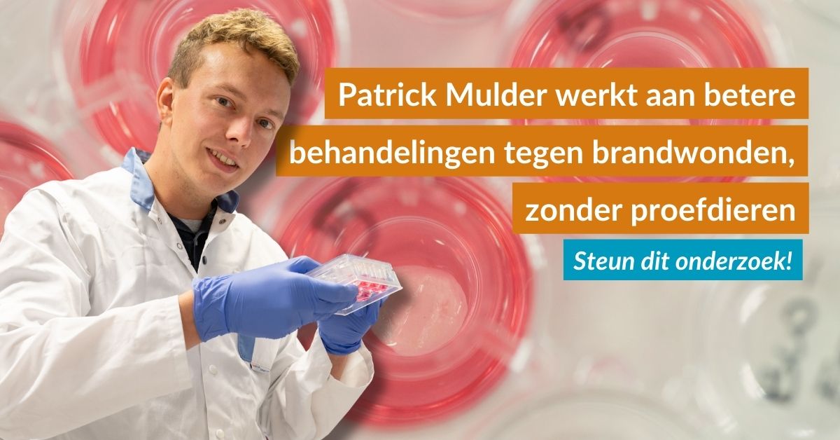 Brandwondenonderzoek zonder proefdieren. Kan het straks? - Proefdiervrij