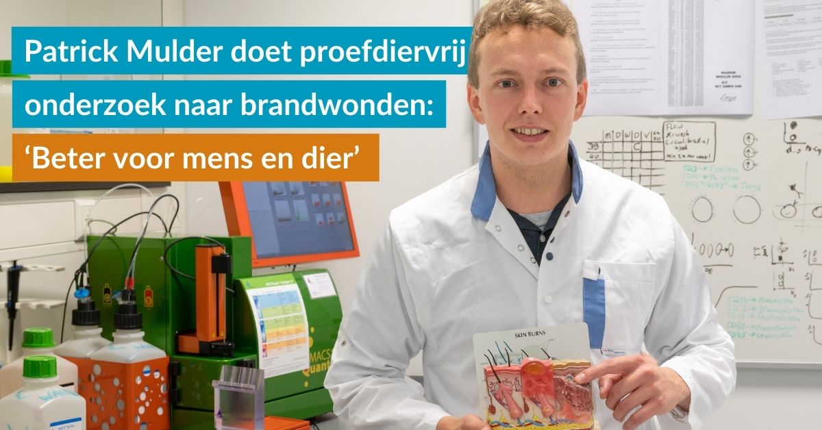 Patrick conducts animal-free burn research: "With each piece of ...